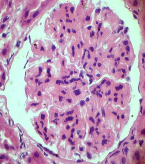 Light Microscopy Glomerulus Lobular Appearance Mesangial And