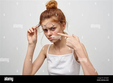 Red Haired Woman Wearing Glasses Pimple On Face Dermatology Skin Care