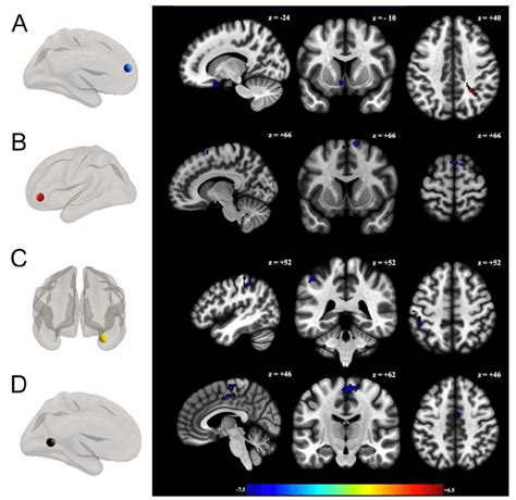Seeds Showing Significant Functional Connectivity Differences Between