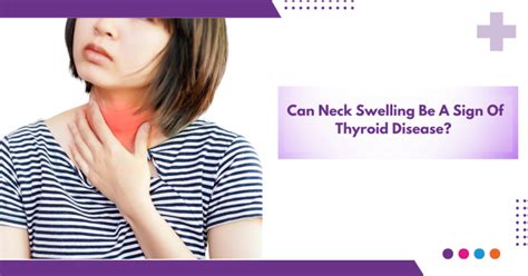 Can Neck Swelling Be A Sign Of Thyroid Disease