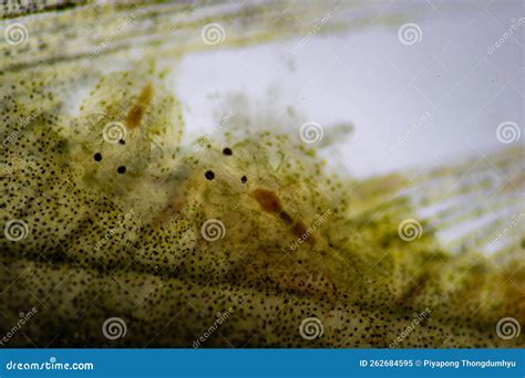 Study Of Argulus Sp And Clinostomum Sp Under Microscope View In