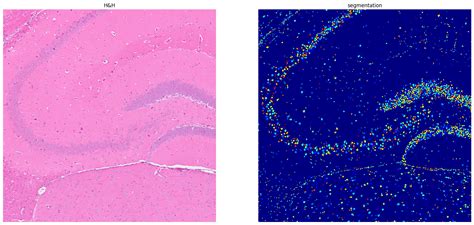 Nuclei Segmentation By Stardist Smurf