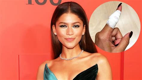 Zendaya Gets Stitches After Kitchen Accident Never Cooking Again