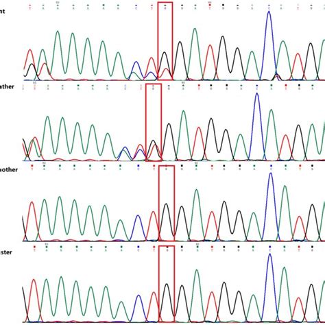 Sequence Analysis Results Of The Mlycd Gene Of The Patient And Her Download Scientific Diagram