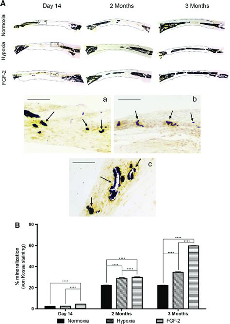 Mineral Formation In Calvarial Bone Defects A Von Kossa Staining