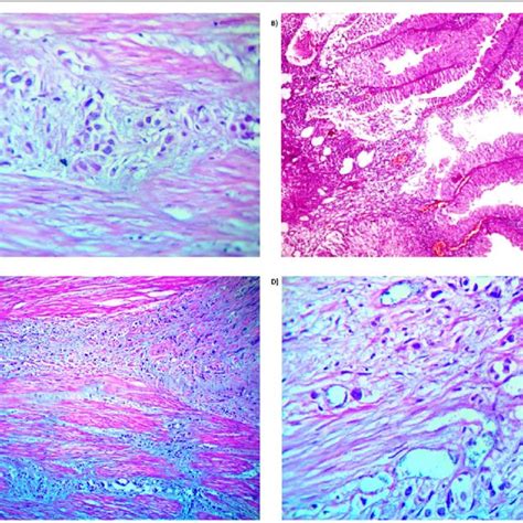 Cross Section Of Urothelial Bladder Tissues Stained With Hande A