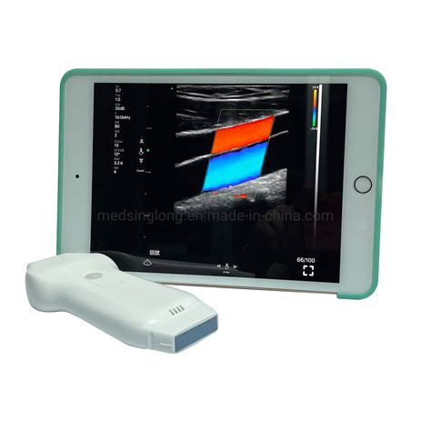 portable linear convex phased array double head probe wireless color