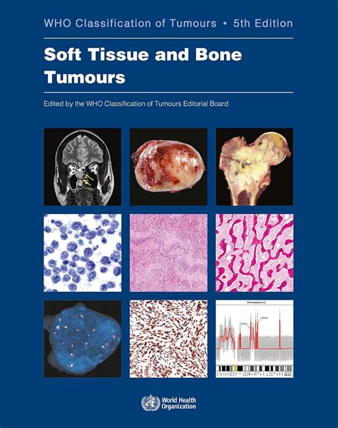 Amazon Soft Tissue And Bone Tumours World Health Organization Classification Of Tumours 3