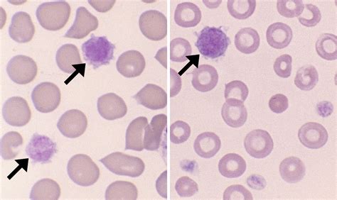 Hematology Cells And Smears