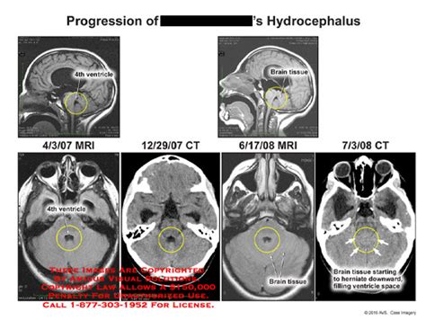 Medical Exhibits Demonstrative Aids Illustrations And Models