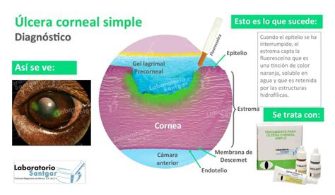 Esquema Úlcera Corneal Simple Laboratorio Santgar