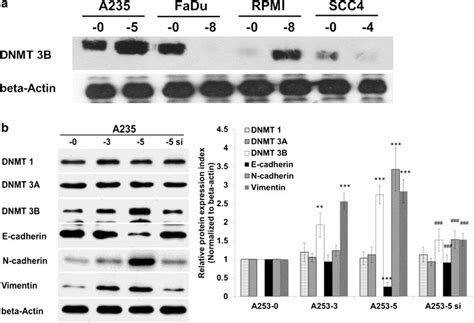 Aberrant Expression Of Dnmt 3b In Hnscc Cell Lines And Knockdown Of Download Scientific Diagram