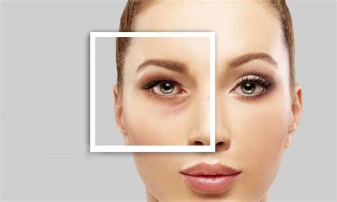 What Is Blepharoplasty Procedure Plastic Surgery