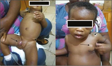 International Journal Of Medicine And Health Development