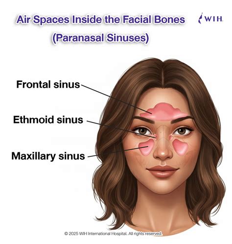 Brow Ridge Reduction Ffs Frontal Sinus Setback
