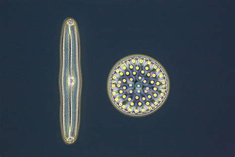 Arranged Slide Diatoms Centric And Pennate Forms F100
