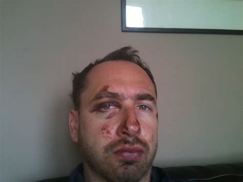 On Being Beaten Up Saul Wordsworth