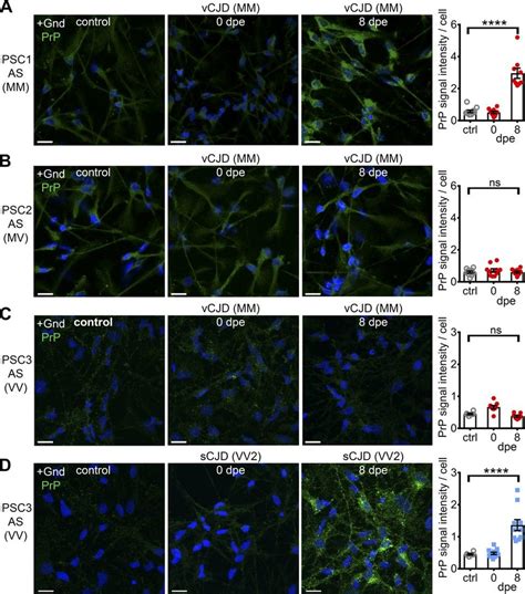 Human Ipsc Derived Astrocytes Accumulate Prpsc When The Cjd Inoculum Download Scientific