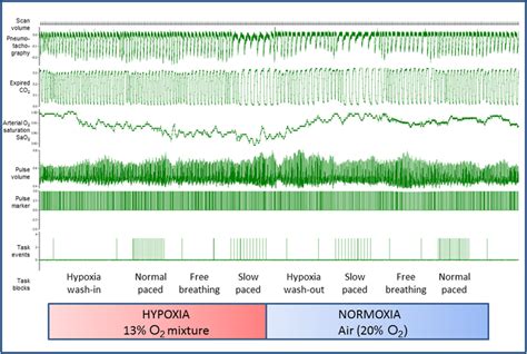 Physiological Data Acquisition Illustrating Experimental Design The