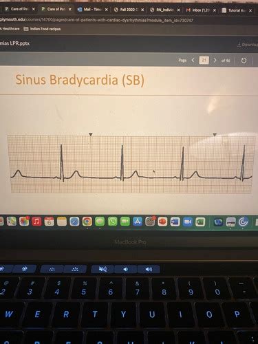 Med Surg Exam 2 Flashcards Quizlet
