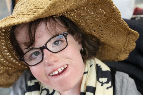 Trisomy 18 Positive Exposure