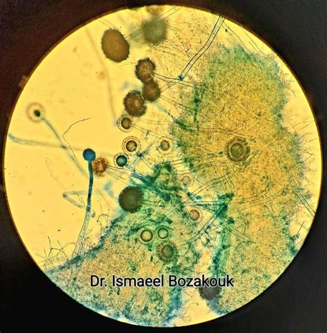 Aspergillus Sp Under Microscope