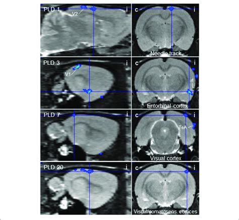 Thalamic Lesion Inhibits Vestibular Stimulation Induced Glucose Download Scientific Diagram