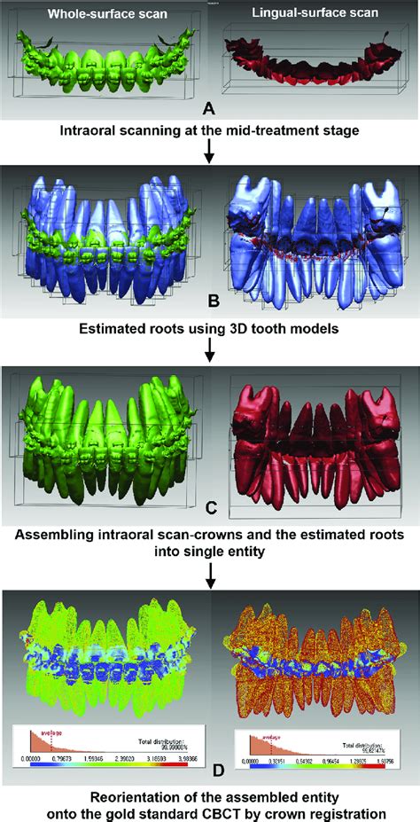 The Procedure Of Estimating The Root Axis Using 3d Tooth Models In The