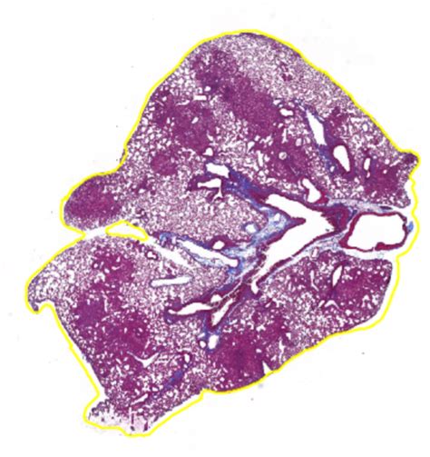 How To Export Tiles Of Large Histology Images In Qupath Carpenter