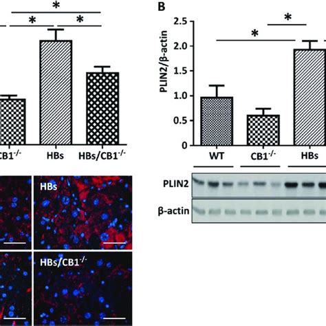 cb1 knockout reduced hepatic plin2 in hbs transgenic mice a
