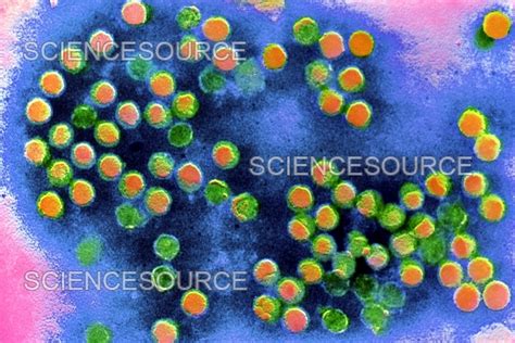 Polio Virus Electron Micrograph