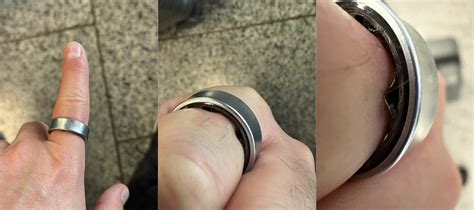 智能指環鋰電池膨脹夾住手指 Youtuber 被禁登機需入院處理 Fitz 運動平台