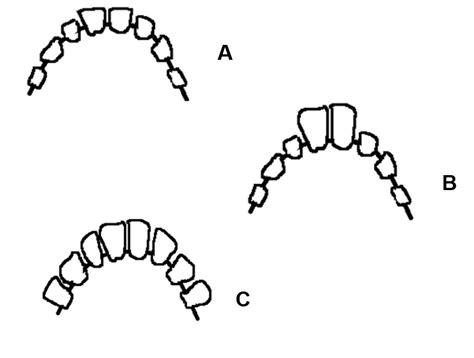 Age Of Sheep Based On Teeth Diagram Quizlet