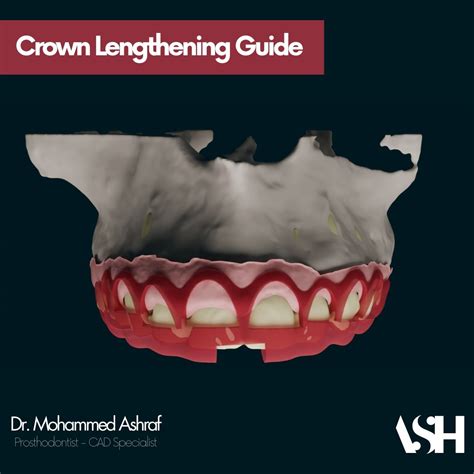 Dr Mohammed Ashraf Drmohammedash • Instagram Photos And Videos