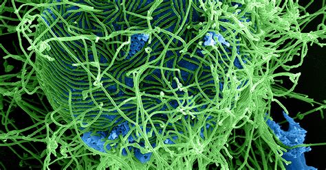 Mrc Breathlessness Scales 1952 And 1959 Ukri