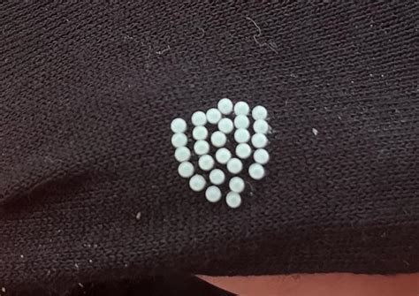Can Someone Identify These Eggs R Insects