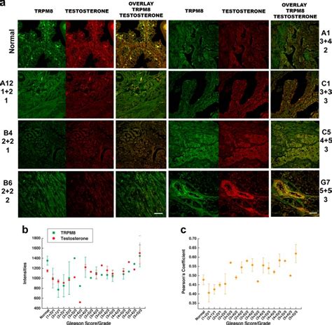 The Trpm8 Protein Is A Testosterone Receptor I Biochemical Evidence