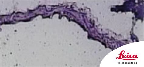 Laser Dissection Microscope Leica At Stephanie Goddard Blog