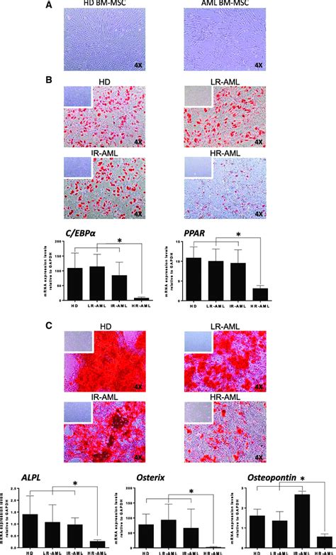 Differentiation Capacity Of Bmmscs From Hds And Aml Patients A