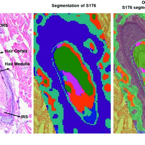 Histology And Segmentation Analysis Of Hair Follicle 3 Download Scientific Diagram