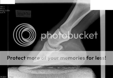 Pedal Bone Definition At Kenneth Locke Blog