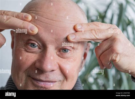 65 Year Old Man Senior Looks Carefully Examines Wrinkles On Face Skin