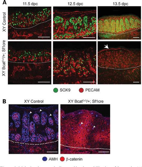 Figure 1 From Stabilization Of Beta Catenin In Xy Gonads Causes Male To