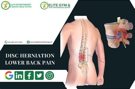 Understanding Disc Herniation And Its Management At Elite Phhysio
