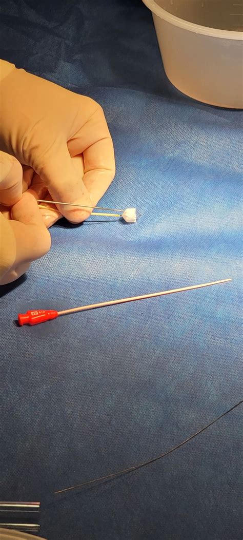 Pulmonary Flow Restrictors Placement Dx 1 8 Kg Iaa Vsd Mvp Modified… Saleem Almasarweh