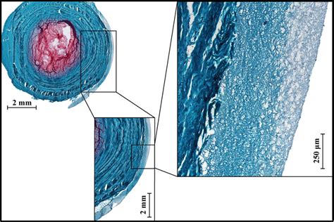 Overview Of The Repair Scaffold And The Interface With The Outer Layers Download Scientific