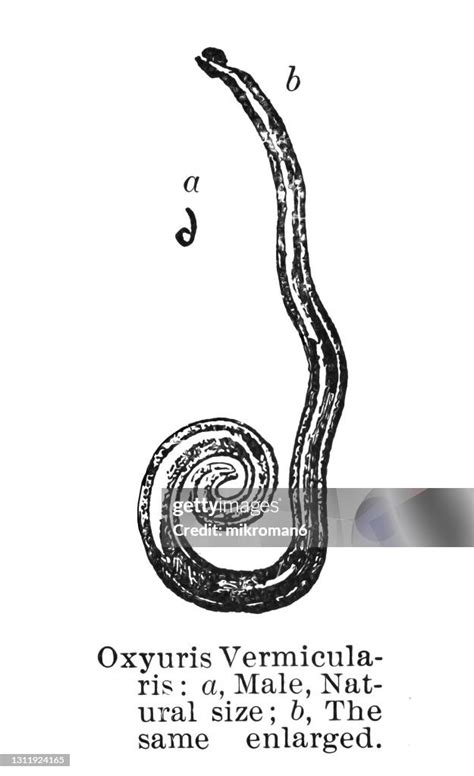 Roundworm Drawing