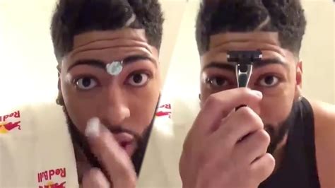 Anthony Davis Ugly
