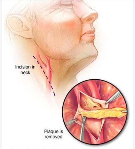 مساء الخير هتكلم معاكم النهاردة عن Bassem Fahmy Shehata Facebook