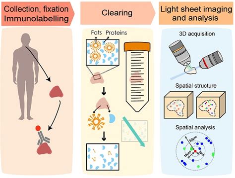 Efficient 3d Imaging And Pathological Analysis Of The Human Lymphoma